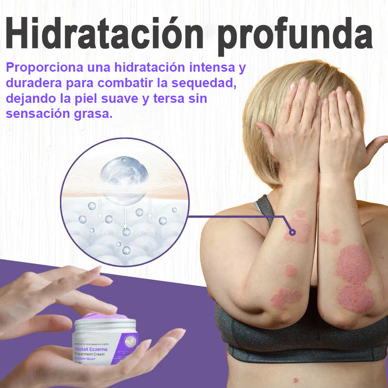 Crema de tratamiento de eccema violeta – Smuksted